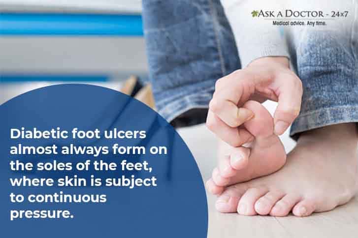Diabetic Foot Ulcers: Why You Should Never Ignore Them, and Remedies to ...